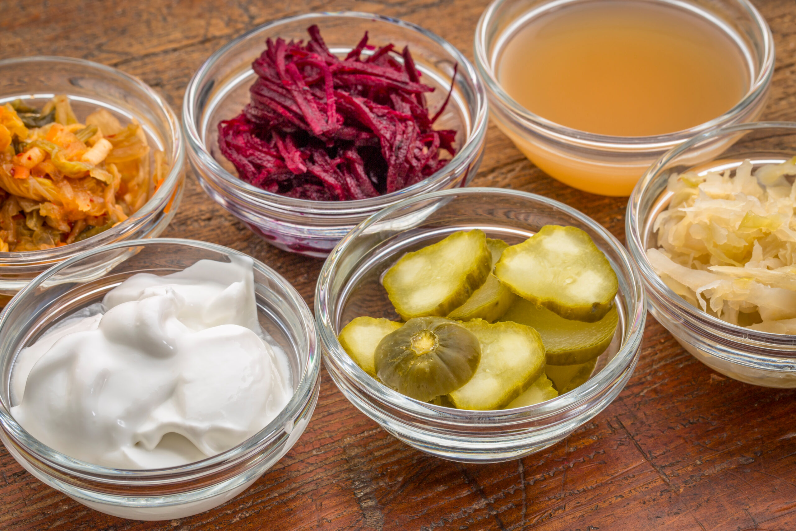 8 Fermented foods that transform your gut health and the benefits | CrispNG